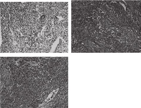 A Histopathology Of The Resected Lung Only The Sequestrated Lung Download Scientific Diagram