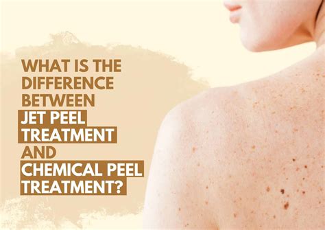 What Is The Difference Between Jet Peel Treatment And Chemical Peel