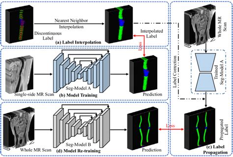 Illustration Of Label Propagation For 3d Carotid Vessel Wall