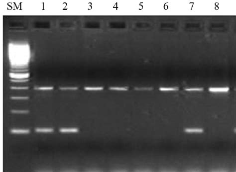Representative Result Of HLA A Genotyping Lane And Show A Download Scientific