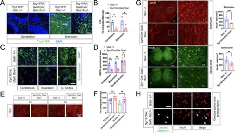 Neuronal Complexity Was Greatly Reduced By Neuronal Galc Depletion A