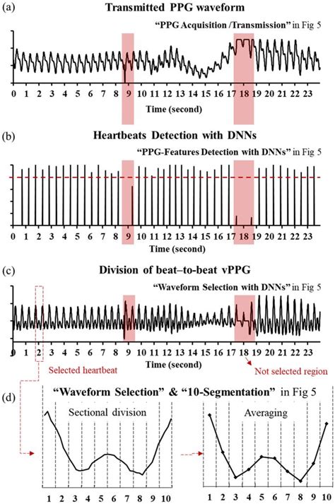 Normalization Of Photoplethysmography Using Deep Neural Networks