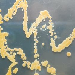 Staphylococcus News Articles IFLScience