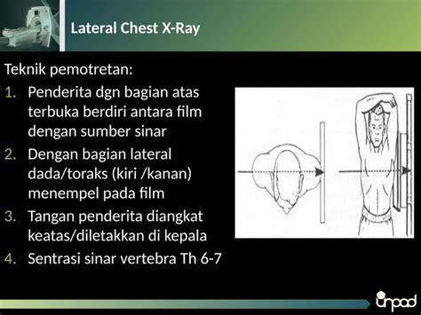 Bahan Thorax Normal Untuk Radiologi Pptx Pptx