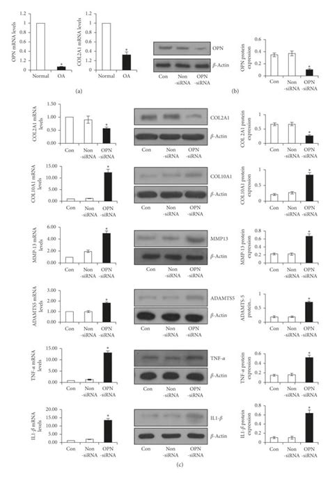 Expressions Of Opn And Col2a1 Of The Human Oa Chondrocytes And Effects Download Scientific