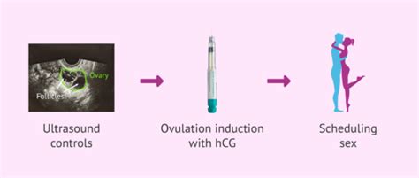 Timed Intercourse In Women With PCOS