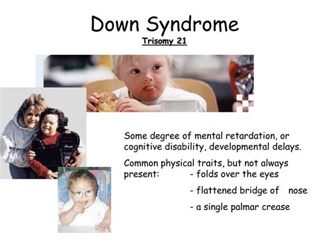 Ppt Classifying Genetic Disorders Powerpoint Presentation Free