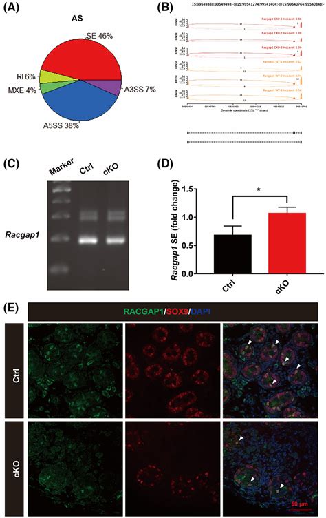 Srsf2 In Sertoli Cells Is Essential For Testicular Development And