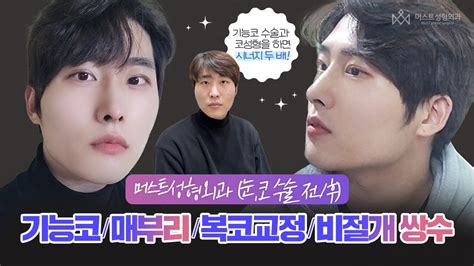 머스트 성형외과 기능코 매부리코 복코교정 비절개 쌍수 수술 전후 Youtube