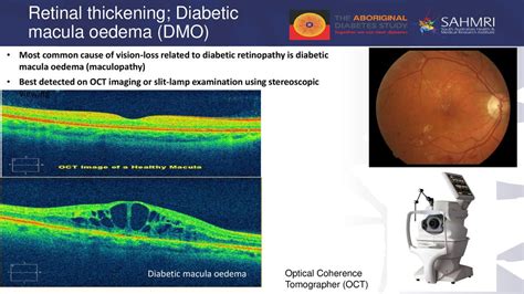Achsa Gp Forum José Estevez 1808 Ppt Download