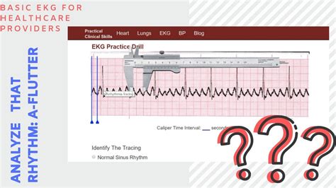 analyze that ekg rhythm atrial flutter a flutter youtube