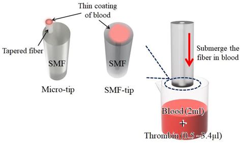 Fabry Perot Interferometric Fiber Optic Sensor For Rapid And Accurate Thrombus Detection
