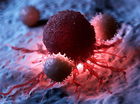 What Is Neoplasm Its Symptoms And Treatment