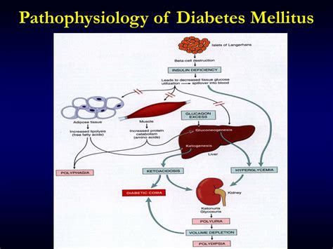 Diabetes Mellitus Type 2 Pathophysiology Mellitus Pathophysiology T2dm Alhassan Universiti