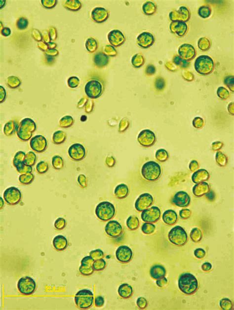Algae Eats Other Plants Strange Plants Live Science