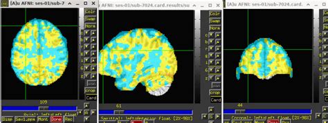 Afniprocpy With Fmriprep Outputs Questions On Masking And Clustering Afni Message Board