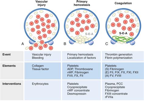Transfusion And Coagulation Therapy Clinical Tree