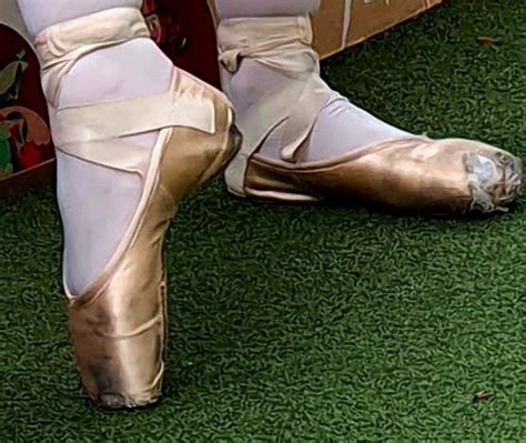 Ballerina Feet First Aid Wound Care