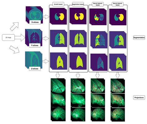 Projections Dataset Creation Flow Using 4 Segmentation Variants In Download Scientific Diagram