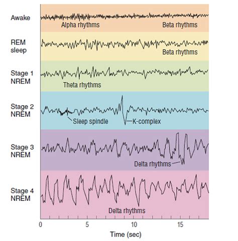 Solved Why Are The Awake And Rem Sleep Stages Both Similar