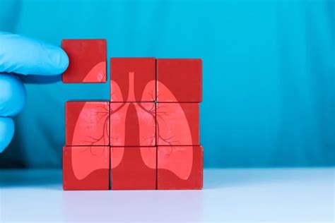 Czym Jest Test Quantiferon Centrum Wiedzy Alab Laboratoria