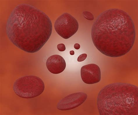 Macrocytosis Is A Condition In Which Your Red Blood Cells Are Larger