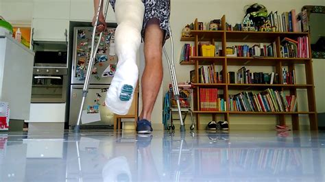 Crutching In My Fresh Long Leg Cast With Toe Plate And Walking Heel