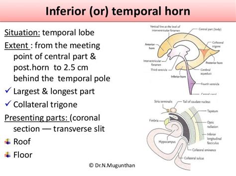 Lateral Ventricle Of Brain By Drnmugunthanms