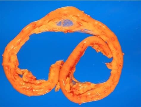 Path 3 Quiz Questions Flashcards Quizlet