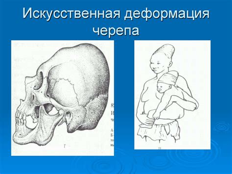 Развитие и рост костей Развитие головы варианты и аномалии Формирование скелета ротовой