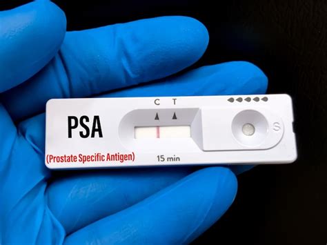 premium photo rapid diagnostic test for psa prostate specific antigen with a negative result