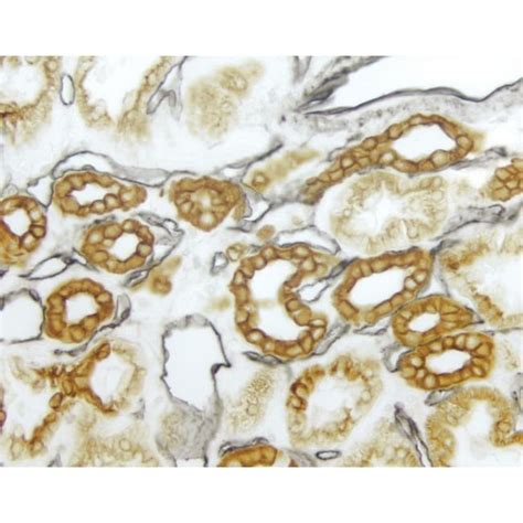 Vector Laboratories Dab Peroxidase Hrp Substrate Kit With Nickel 3 3 Diaminobenzidine