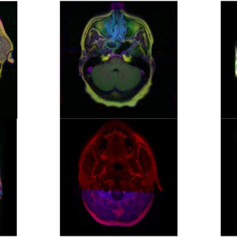 Sample Images From Different Classes Of Lgg Segmentation Dataset