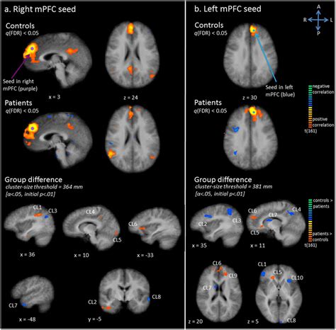 Functional Connectivity Fc Maps For The Medial Prefrontal Cortex Download Scientific Diagram