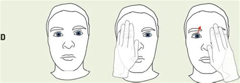 Head Impulse Nystagmus Og Test Of Skew Hints Test Lægenoter