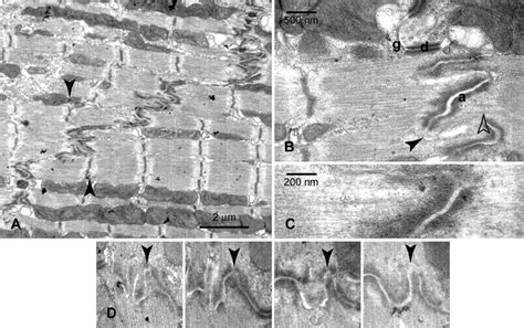 Intercalated Discs Allow The Heart To