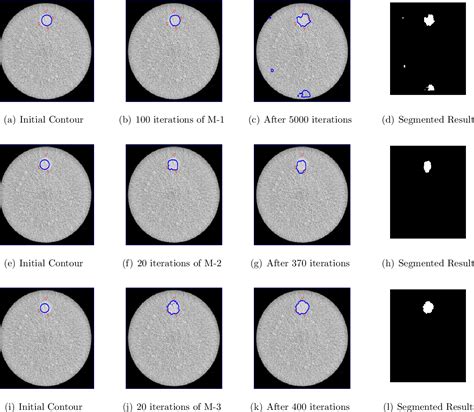 Figure 6 From A Coeﬃcient Of Variation Based Image Selective Segmentation Model Using Active