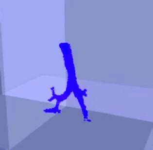 Illustration Of The Lung Segmentation From CT Image Analyzed By Two Download Scientific Diagram