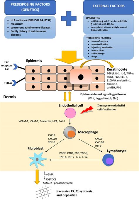 The Etiopathogenesis Of Localized Scleroderma [3 26 30] Download Scientific Diagram