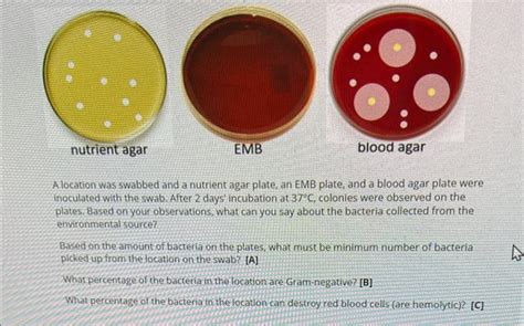 A Location Was Swabbed And A Nutrient Agar Plate An