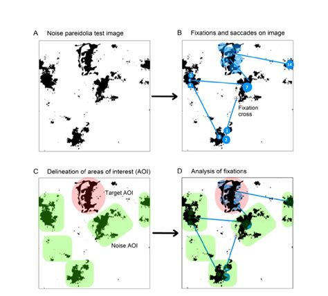 Overview Of Methodology For Eye Tracking In A Noise Pareidolia Test Download Scientific