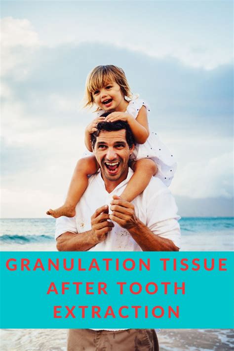 Granulation Tissue After Tooth Extraction