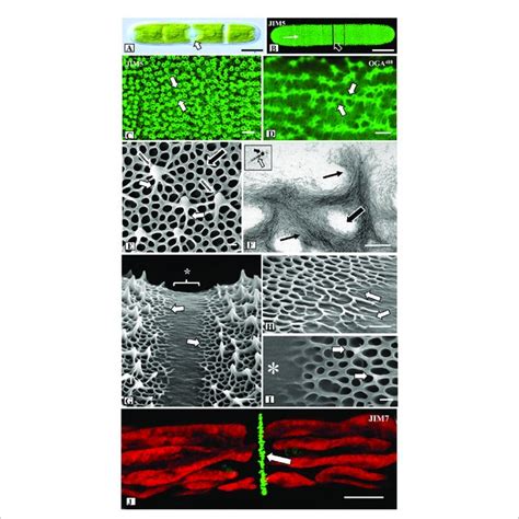 Fine Structural Details Of Lattice Alterations A Cell Shape
