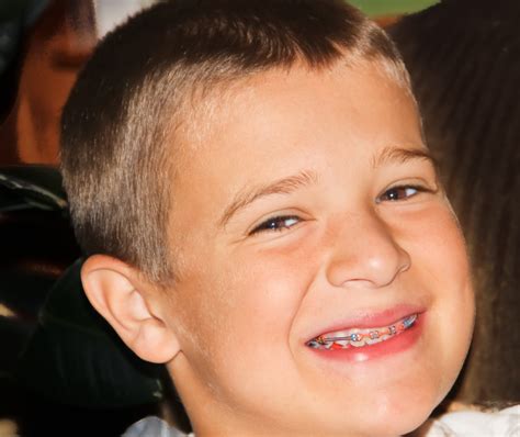 Tips For Picking The Right Color For Your Braces