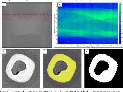 Figure 1 From Quantum Optimization Algorithms For Ct Image Segmentation From X Ray Data
