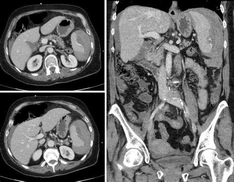 How To Add Scrollable Ct Or Mri Images To A Powerpoint Slide