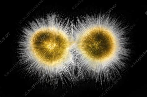 Gloeotrichia Sp Cyanobacteria Light Micrograph Stock Image C056 8357 Science Photo Library
