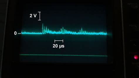 Body Ultrasound Sonography With Arduino 3 Steps With Pictures