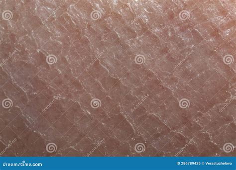 Macrophotograph Of Human Skin Under Microscope Manified 5x Medicine