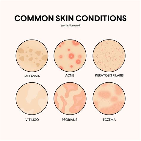 18 Acute Skin Rashes For Nurses To Know With Pictures Artofit
